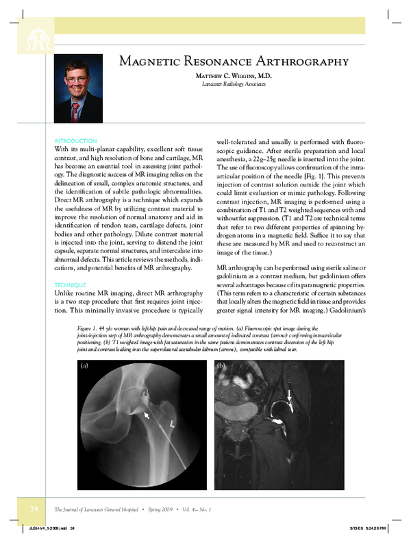 (PDF) Magnetic Resonance Arthrography