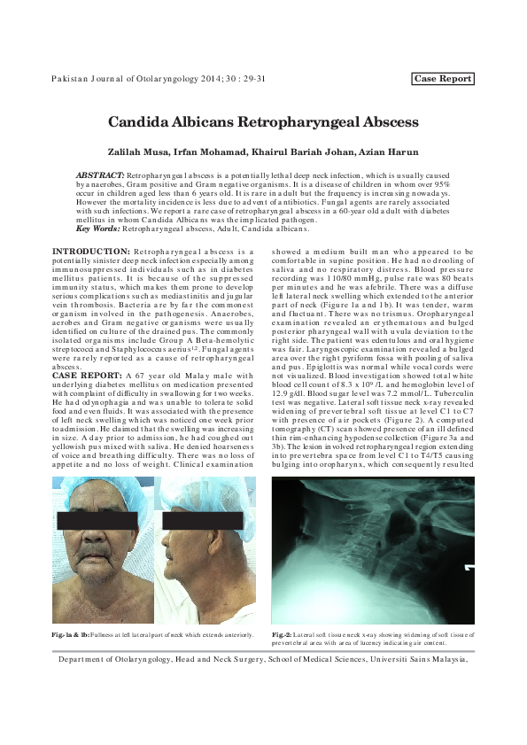 (PDF) Candida albicans Retropharyngeal Abscess