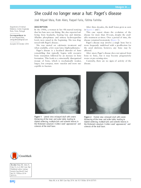 (PDF) She could no longer wear a hat: Paget's disease | Rute Alves ...