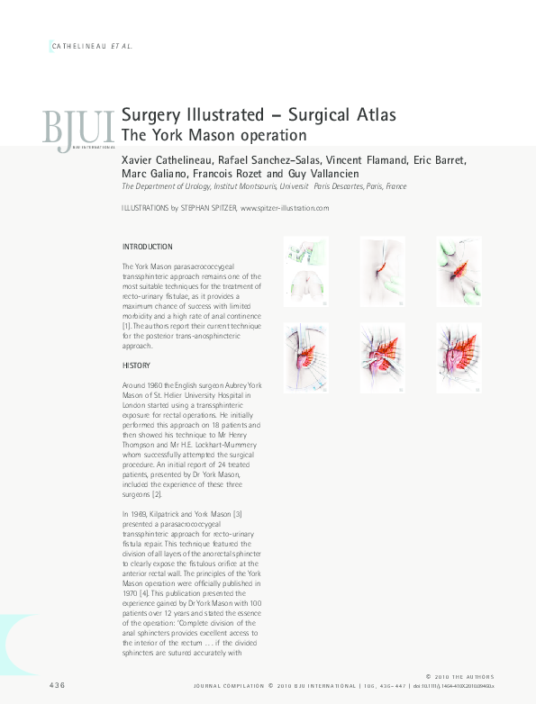 (PDF) The York Mason operation: SURGERY ILLUSTRATED