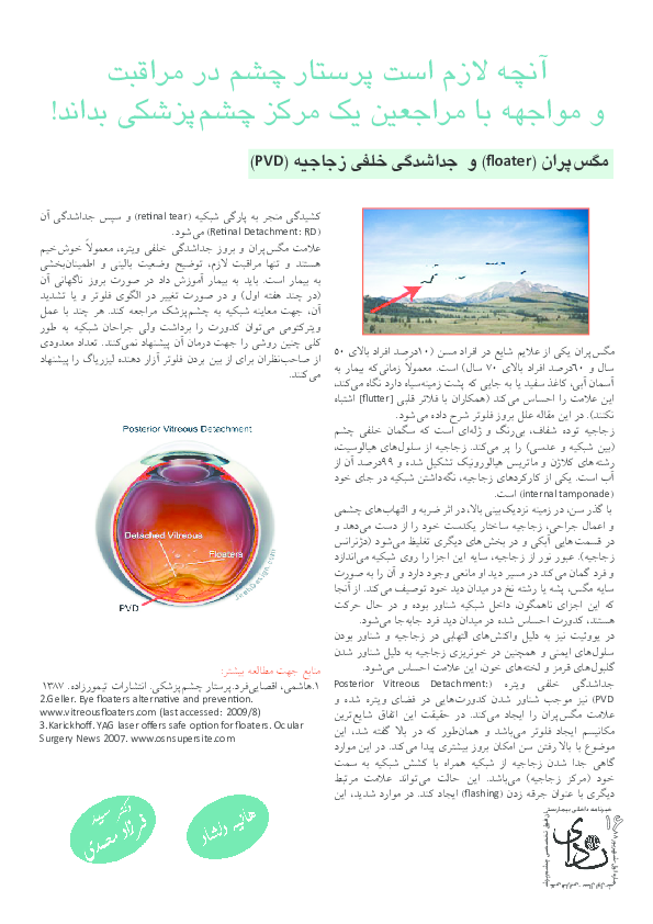(PDF) Floater & Posterior Vitreous Detachment (PVD) (in Farsi)