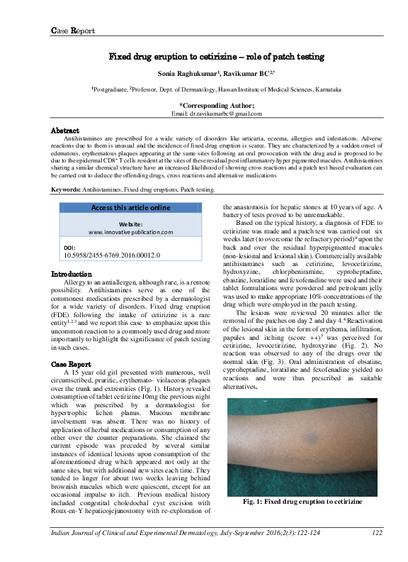 (PDF) Fixed drug eruption to cetirizine – role of patch testing