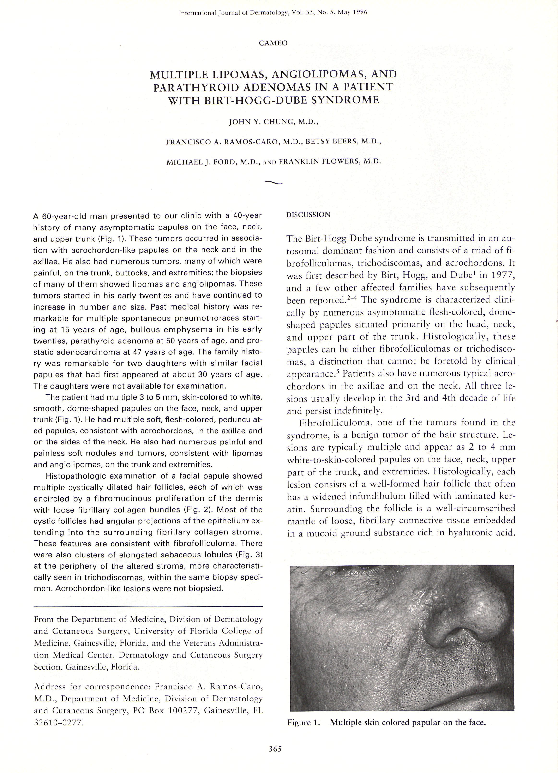 (PDF) MULTIPLE LIPOMAS, ANGIOLIPOMAS, AND PARATHYROID ADENOMAS IN A ...