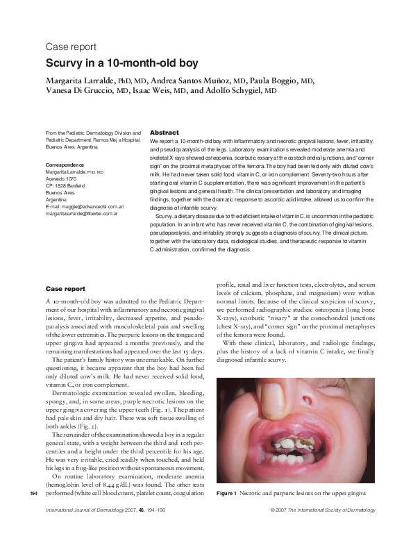 (PDF) Scurvy in a 10-month-old boy: Scurvy in an infant