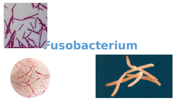 (PPT) Fusobacterium