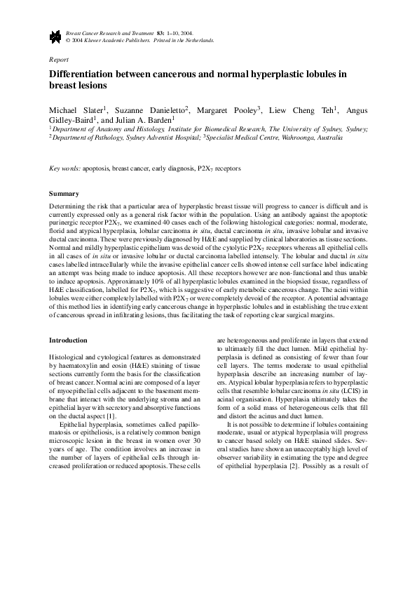 (PDF) Differentiation between Cancerous and Normal Hyperplastic Lobules ...