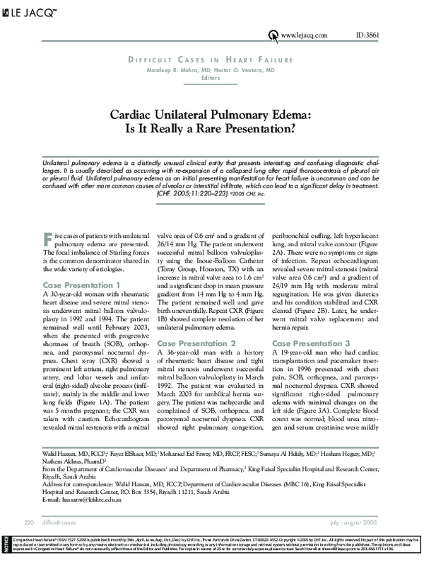 (PDF) Cardiac Unilateral Pulmonary Edema: Is It Really a Rare Presentation