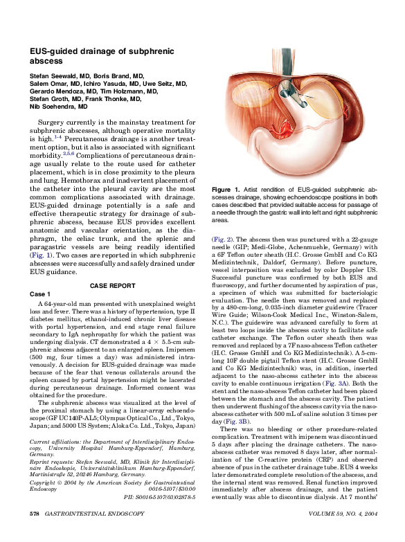 (PDF) EUS-guided drainage of subphrenic abscess