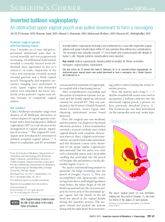(PDF) Inverted balloon vaginoplasty