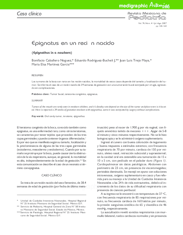 (PDF) Epignathus in a newborn | Bonifacio Caballero Noguéz - Academia.edu