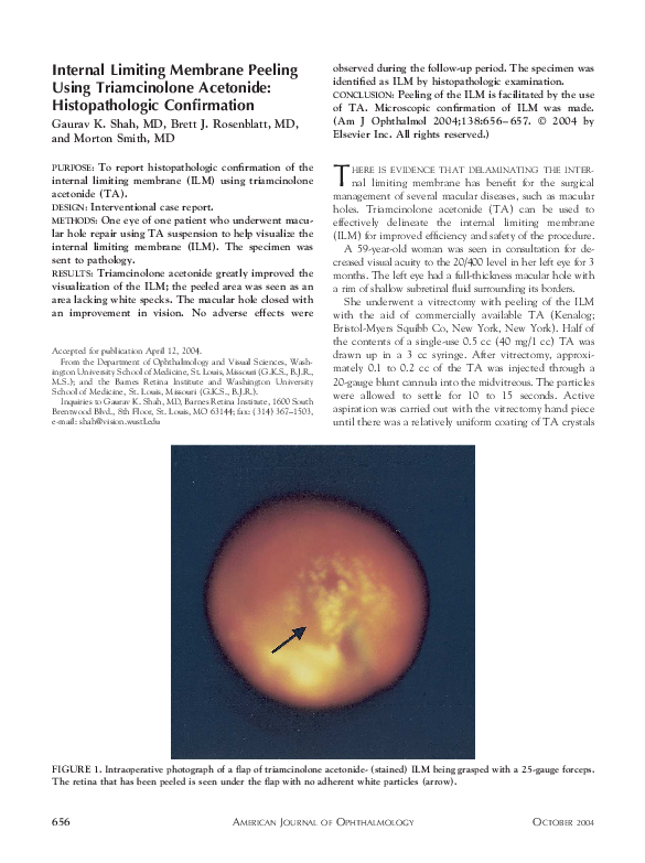 (PDF) Internal limiting membrane peeling using triamcinolone acetonide: Histopathologic confirmation