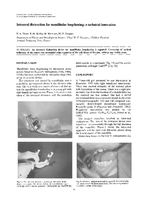 (PDF) Intraoral distraction for mandibular lengthening: a technical ...
