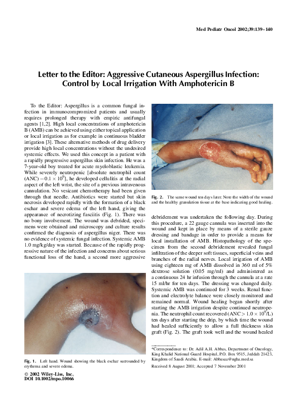 (PDF) Aggressive cutaneous aspergillus infection: Control by local ...