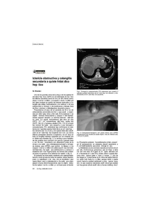 (PDF) Ictericia obstructiva y colangitis secundaria a quiste hidatídico ...