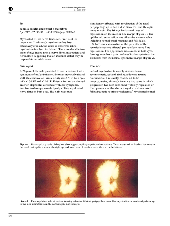 (PDF) Familial myelinated retinal nerve fibres | Charlotte Funnell ...
