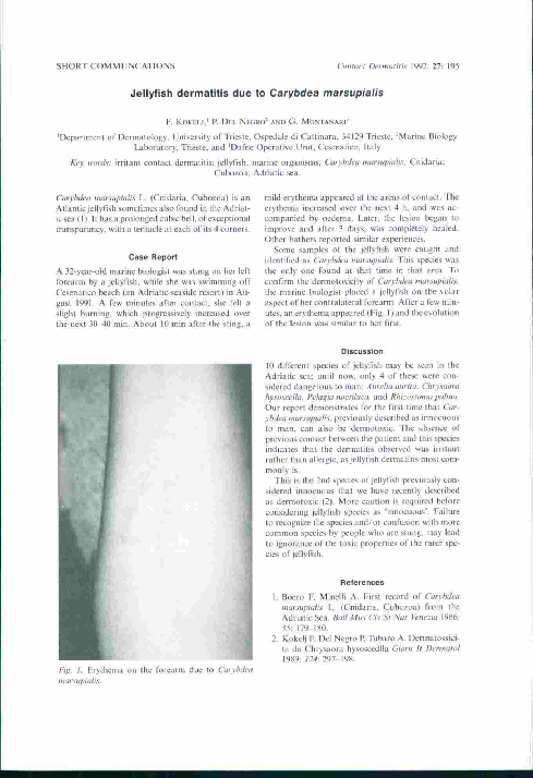 (PDF) Jellyfish dermatitis due to Carybdea marsupialis