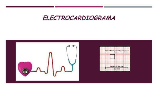 (PPT) Electrocardiograma