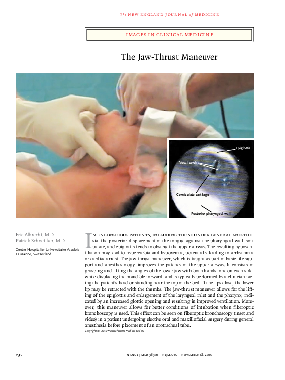 (PDF) The Jaw-Thrust Maneuver