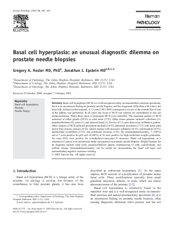 (PDF) Basal cell hyperplasia: an unusual diagnostic dilemma on prostate ...
