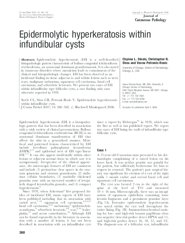 (PDF) Epidermolytic hyperkeratosis within infundibular cysts