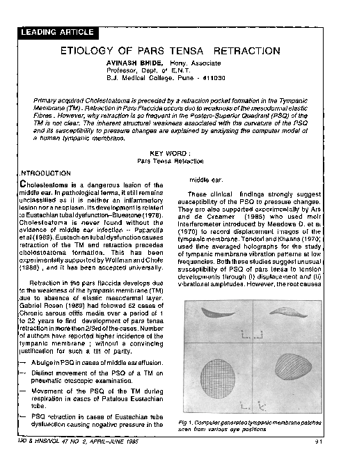 (PDF) Etiology of Pars Tensa Retraction