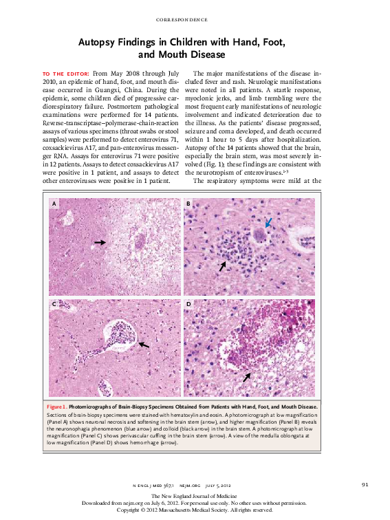 (PDF) Autopsy Findings in Children with Hand, Foot, and Mouth Disease ...