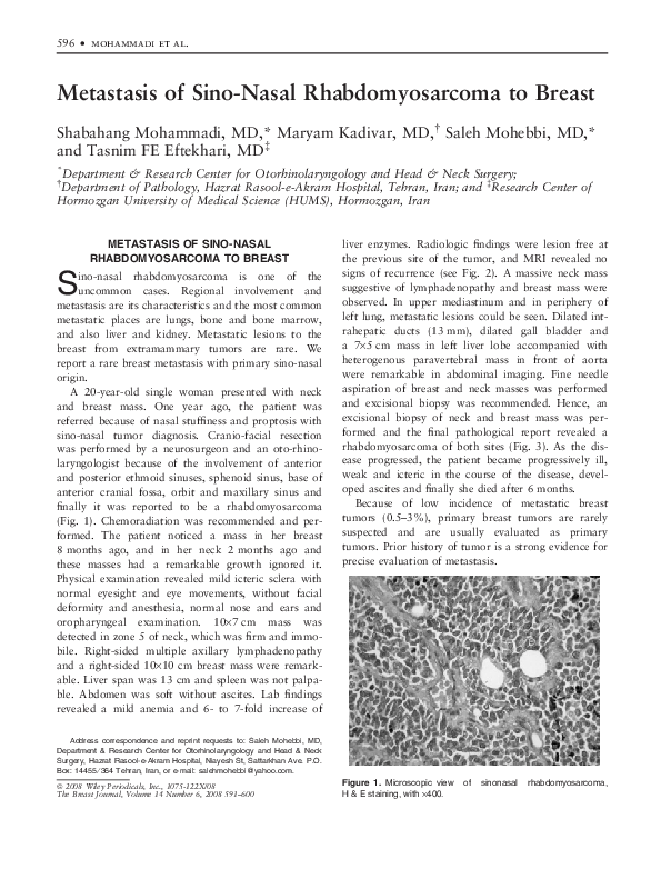 (PDF) Metastasis of Sino‐Nasal Rhabdomyosarcoma to Breast