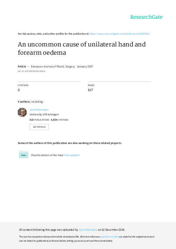 (PDF) An uncommon cause of unilateral hand and forearm oedema