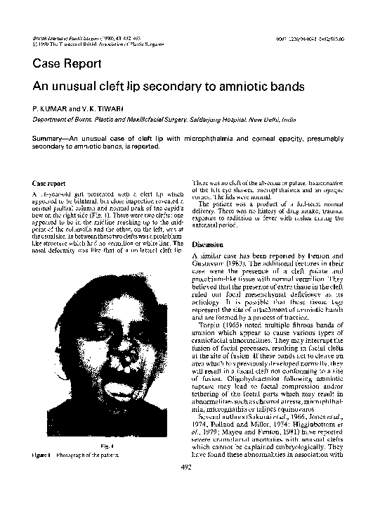 (PDF) An unusual cleft lip secondary to amniotic bands