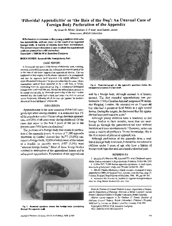 (PDF) ‘Pilonidal appendicitis’ or ‘the hair of the dog’: An unusual ...