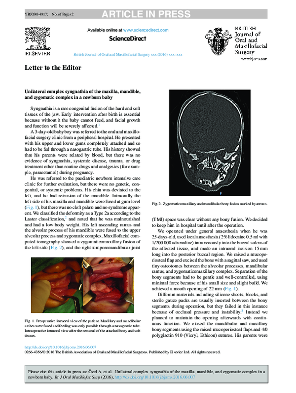 (PDF) Unilateral complex syngnathia of the maxilla, mandible,and ...
