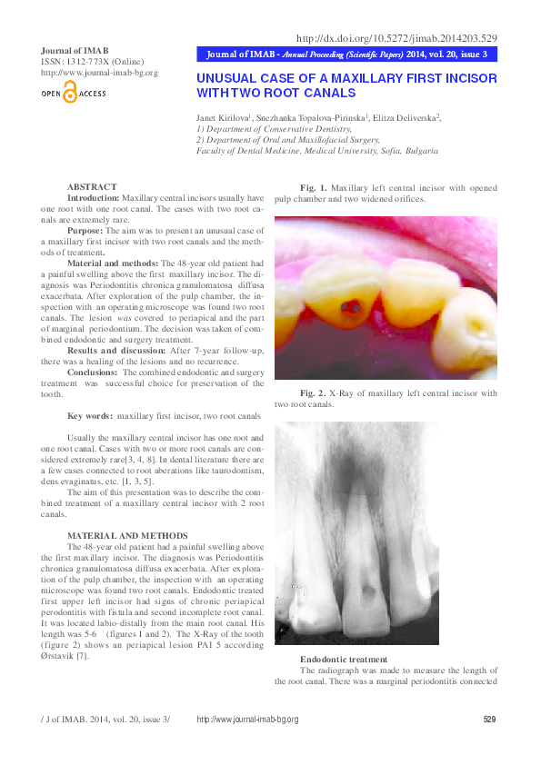(PDF) Unusual Case of a Maxillary First Incisor with Two Root Canals
