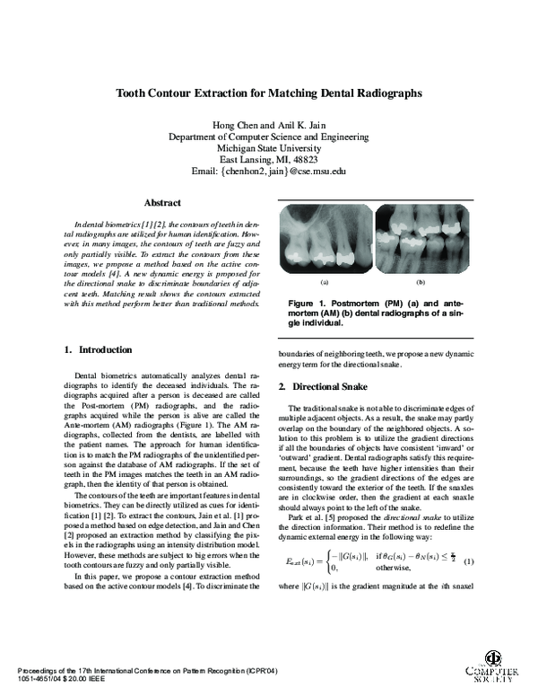 (PDF) Tooth Contour Extraction for Matching Dental Radiographs