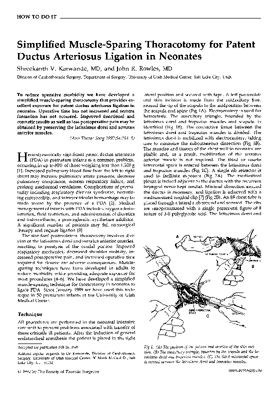 (PDF) Simplified muscle-sparing thoracotomy for patent ductus ...