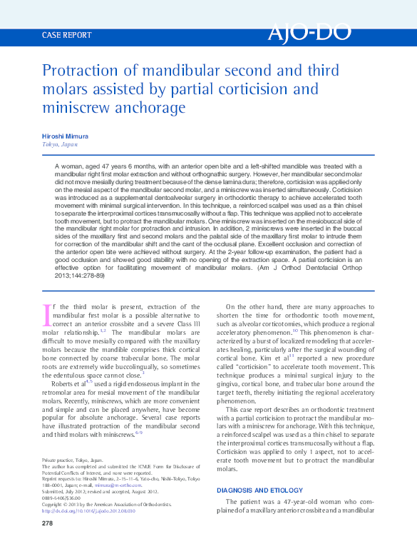 (PDF) Protraction of mandibular second and third molars assisted by ...