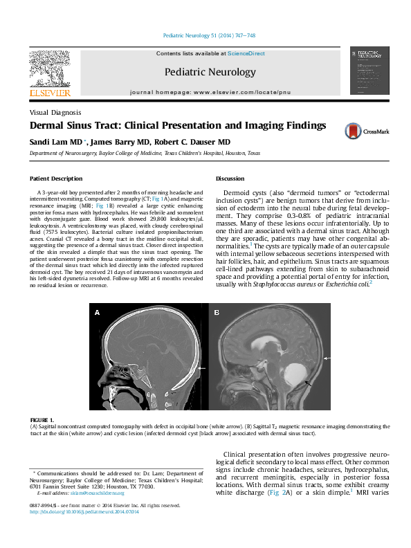 (PDF) Dermal sinus tract: clinical presentation and imaging findings