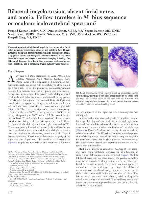 (PDF) Bilateral incyclotorsion, absent facial nerve, and anotia: Fellow ...
