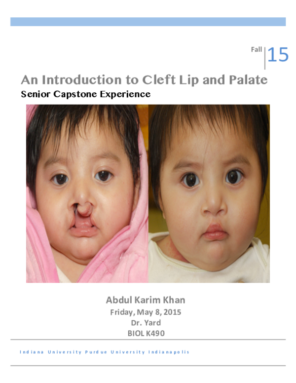 (PDF) An Introduction to Cleft Lip and Palate Senior Capstone Experience