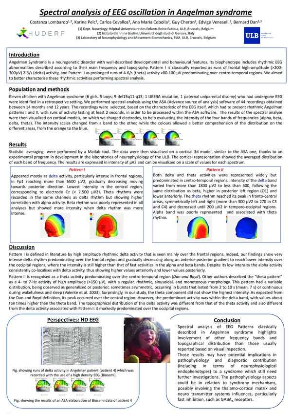 (PDF) Spectral analysis of EEG oscillation in Angelman syndrome