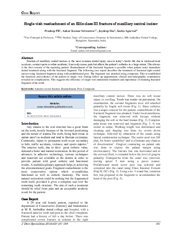 (PDF) Single visit reattachment of an Ellis class III fracture of ...