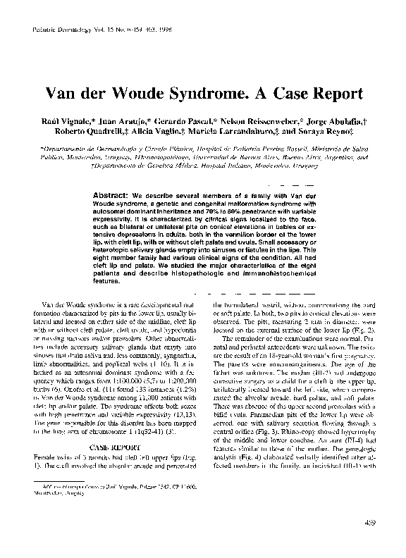 Van der Woude syndrome. A case report