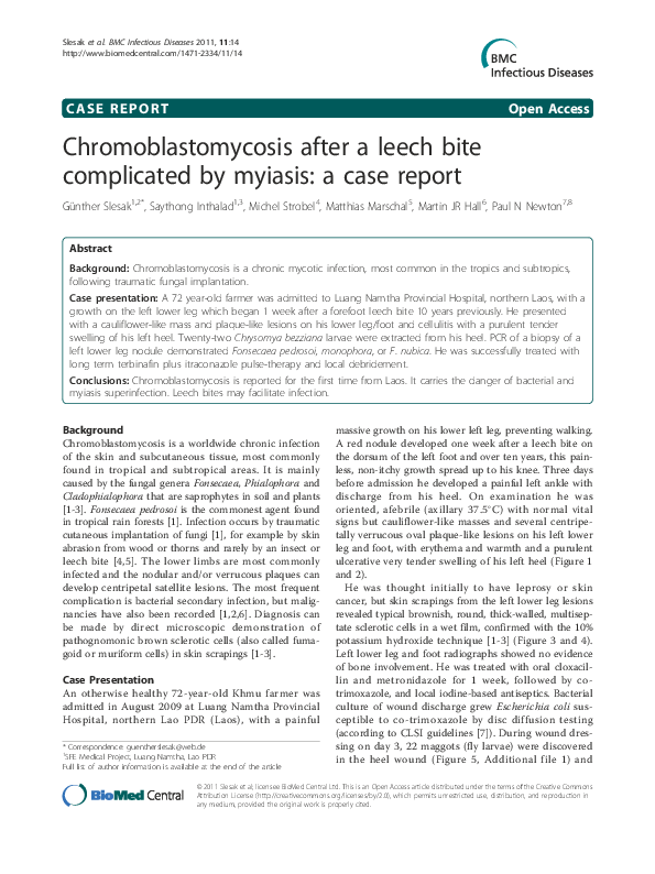 (PDF) Chromoblastomycosis after a leech bite complicated by myiasis: a ...