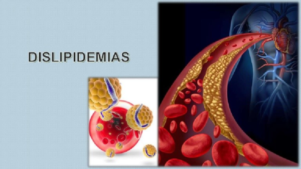 (PPT) Dislipidemias