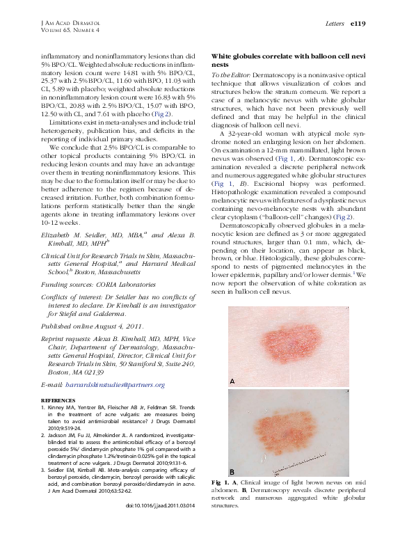 (PDF) White globules correlate with balloon cell nevi nests | Natalia ...