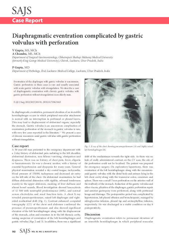 (PDF) Case Report - Diaphragmatic eventration complicated by gastric ...