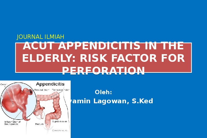 (PPT) Appendisitis Akut Pada Lansia: Dengan Resiko Perforasi