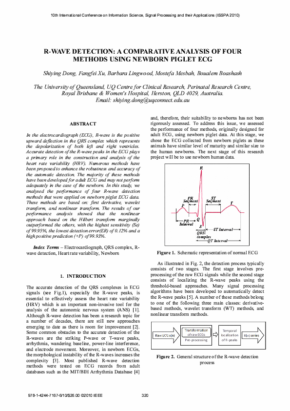(PDF) R-WAVE DETECTION: A COMPA RATIVE ANALYSIS OF FOUR METHODS USING NEWBORN PIGLET ECG