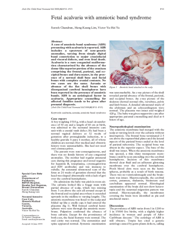 (PDF) Fetal acalvaria with amniotic band syndrome