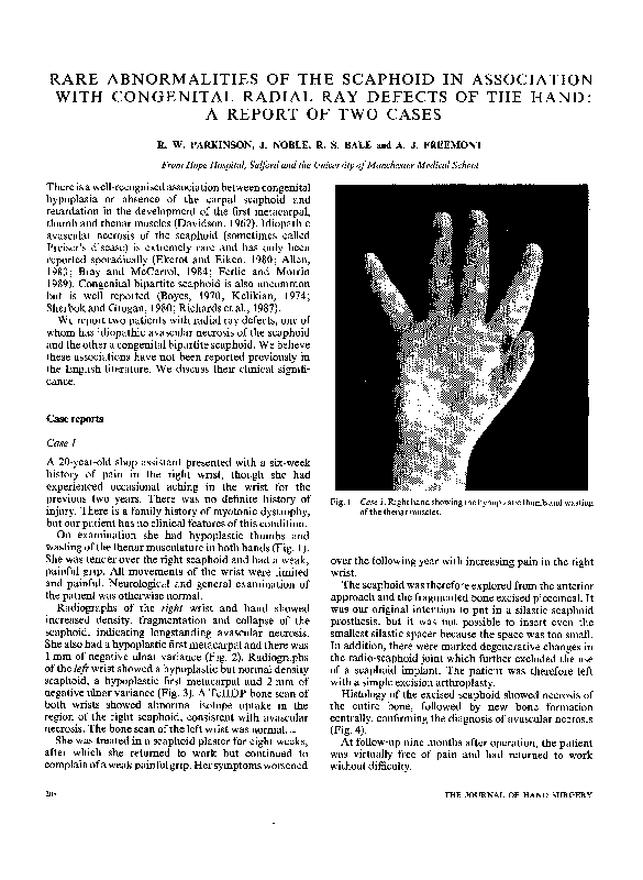 (PDF) Rare abnormalities of the scaphoid in association with congenital ...
