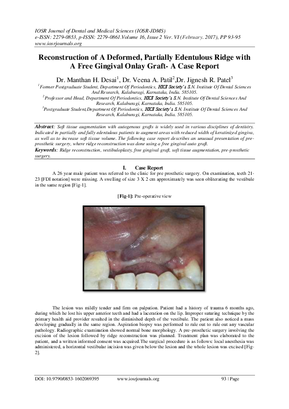 (PDF) Reconstruction of A Deformed, Partially Edentulous Ridge with A ...